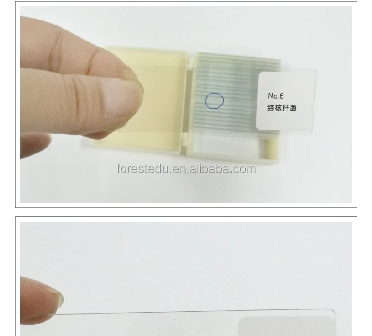 Microbiology Prepared Slides Bacteria Types Higher Education Cocci ...