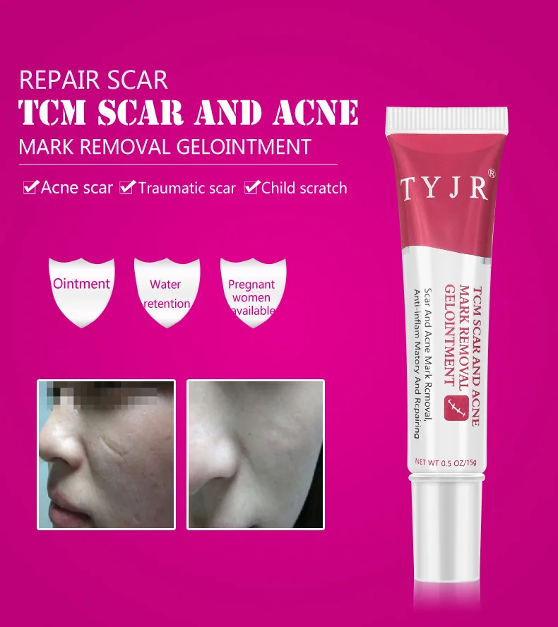 Tyjr 15g Natural Chinese Medicine Scar Repair Cream Postpartum Obesity ...