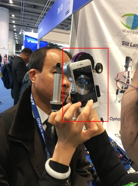 Universal Smartphone Photo Adapter For Slit Lamp - Buy Mobile Phone ...