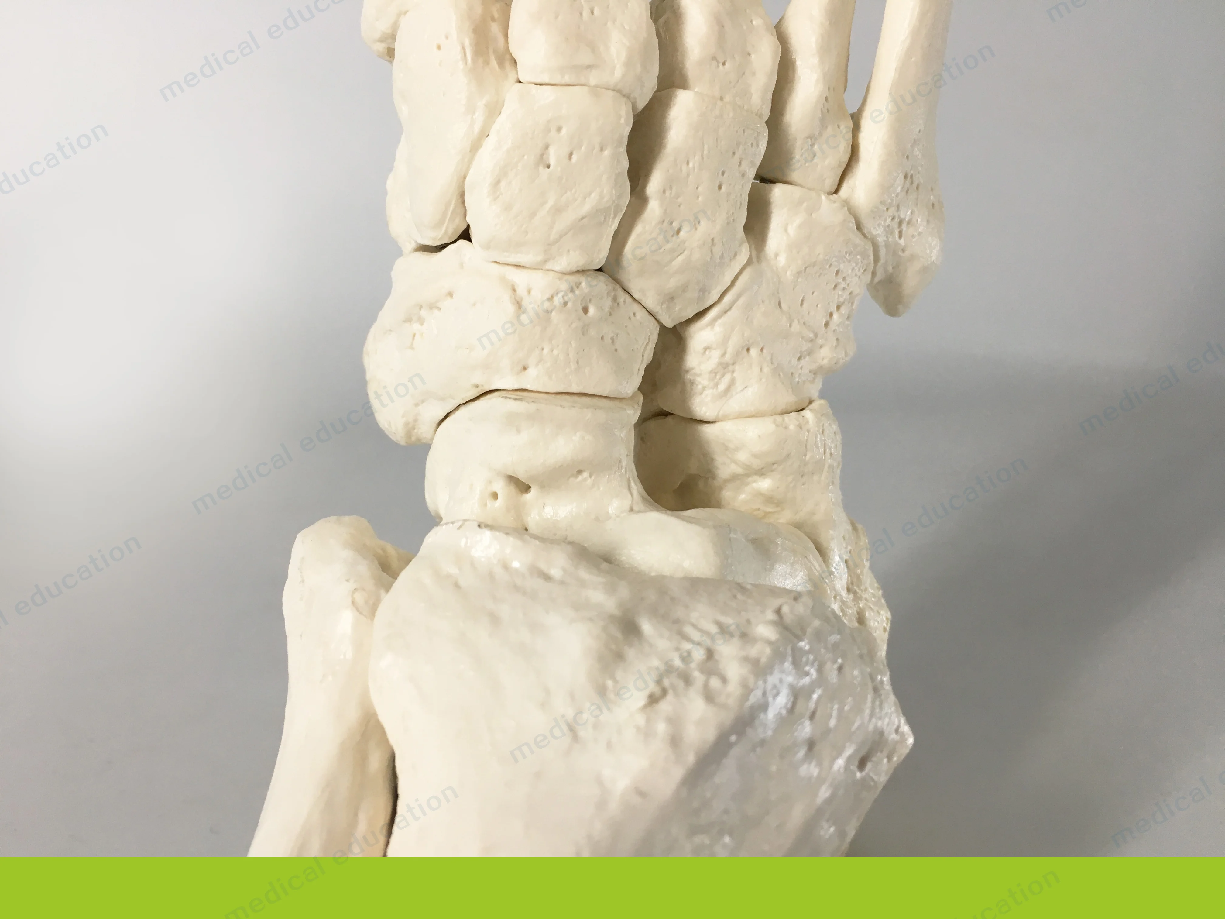 Skeletal Model Simulation Of Orthopaedic Specimens Of Foot,Ankle And ...