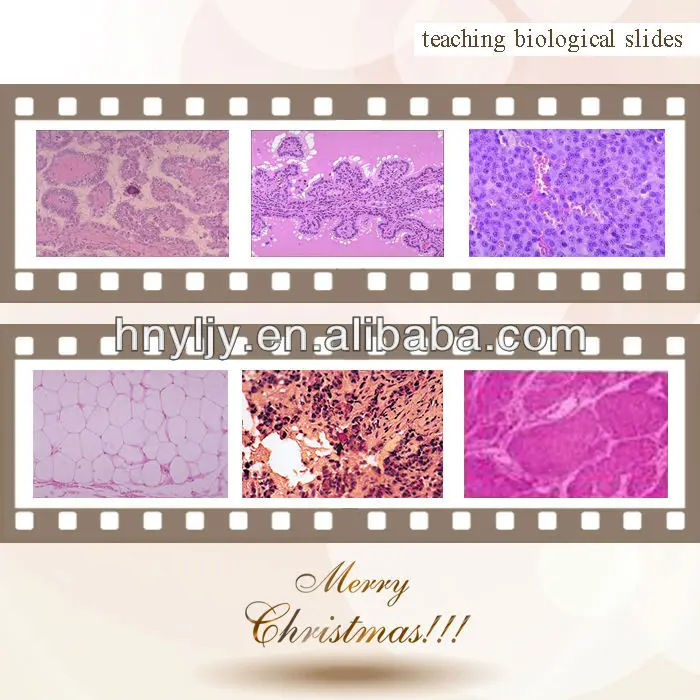 Human Pathology Slides/ Pathology Slides/teaching Pathology Slides ...
