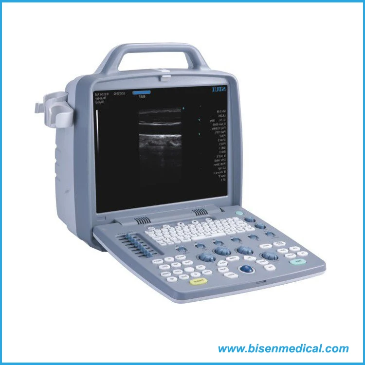 Medical Equipment Pregnancy Scanner Ultrasound/china Portable Price ...