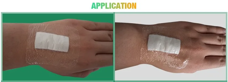 Medical Adhesive Plaster Types Of Iv Cannula Pad Dressing - Buy ...