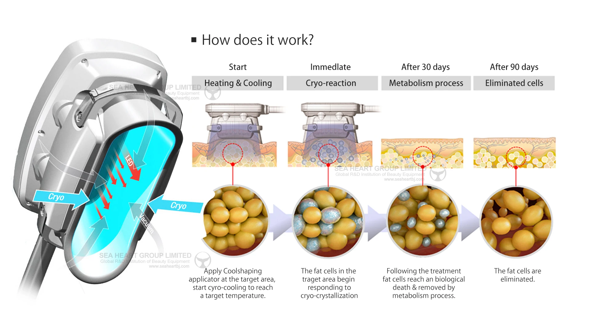 Portable Cryolipolysis 4 Handles Double Chin Fat Freeze Slimming Mini ...