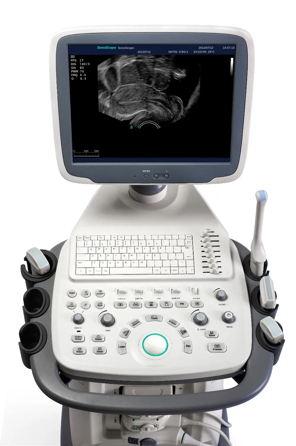 Sonoscape S11 Color Doppler 4d Ultrasound Scanner - Buy 4d Ultrasound ...