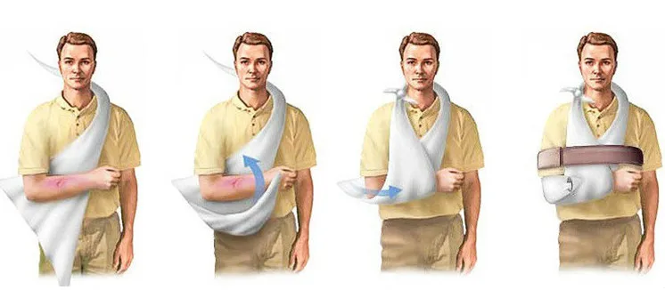 Sh50011-1 Gauze Triangle Bandage - Buy Gauze Triangle Bandage,Bandage ...