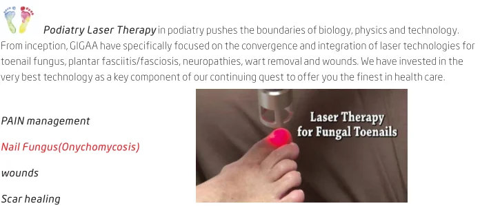 Gbox 980 Nm Diode Laser For Podiatry Treatment Machine - Buy Podiatry ...