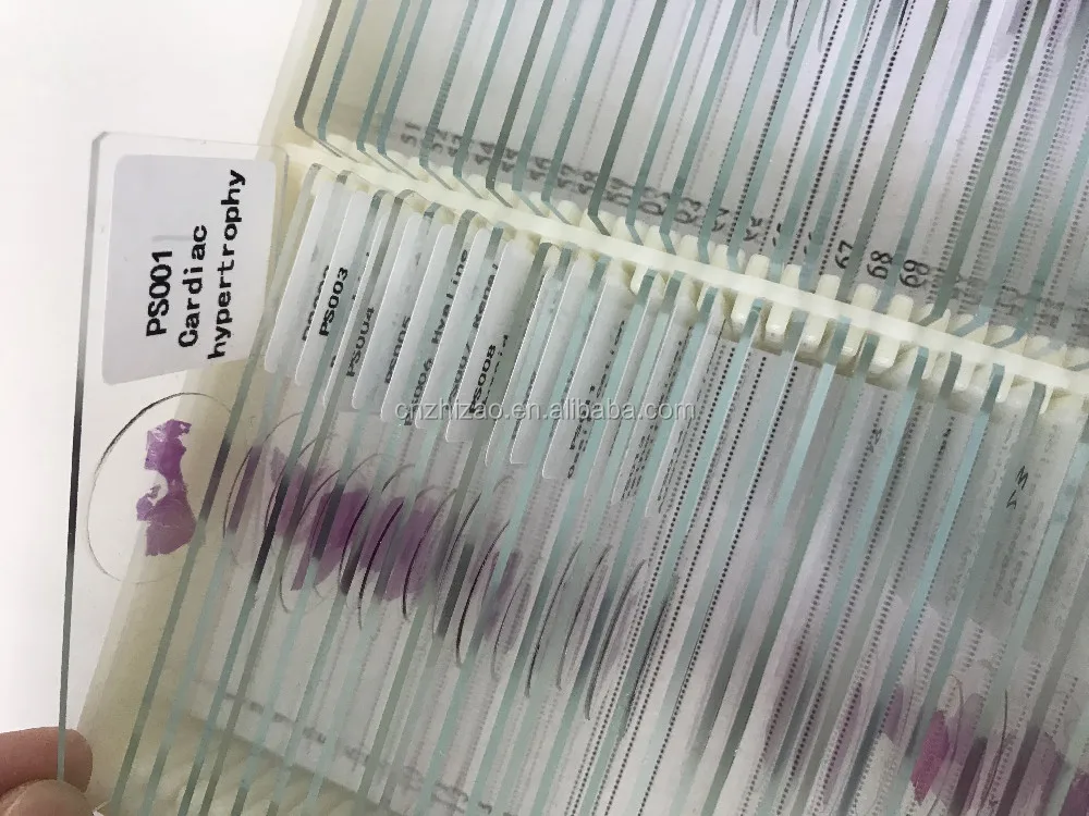 Professional 200 Pieces Set Microscope Human Pathology Prepared Slides ...