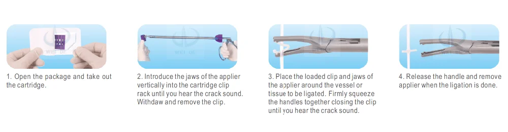 Medical Plastic Ligation Clip/laparoscopic Hem-o-lok Polymer Ligating ...