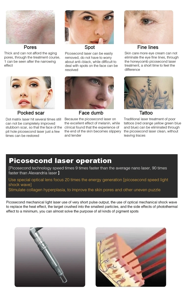 Super Wontech Picocare Laser Tattoo Removal Machine - Buy Wontech ...