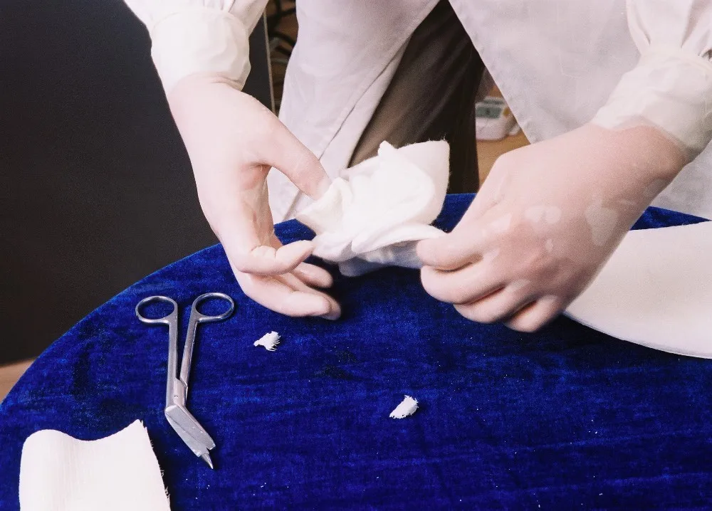 Thermoplastic Splint For Orthopedic Finger Replace Fiberglass Cast ...