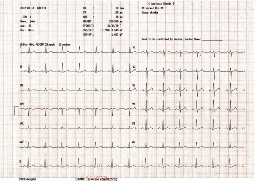 12 Channel Em-1201 Medical Equipment Ecg Or Ekg Machine - Buy Portable ...