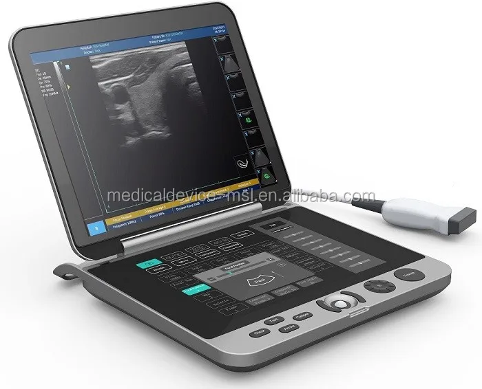 Touch Screen Keyboard Ultrasound Machine With High Frequency Linear ...