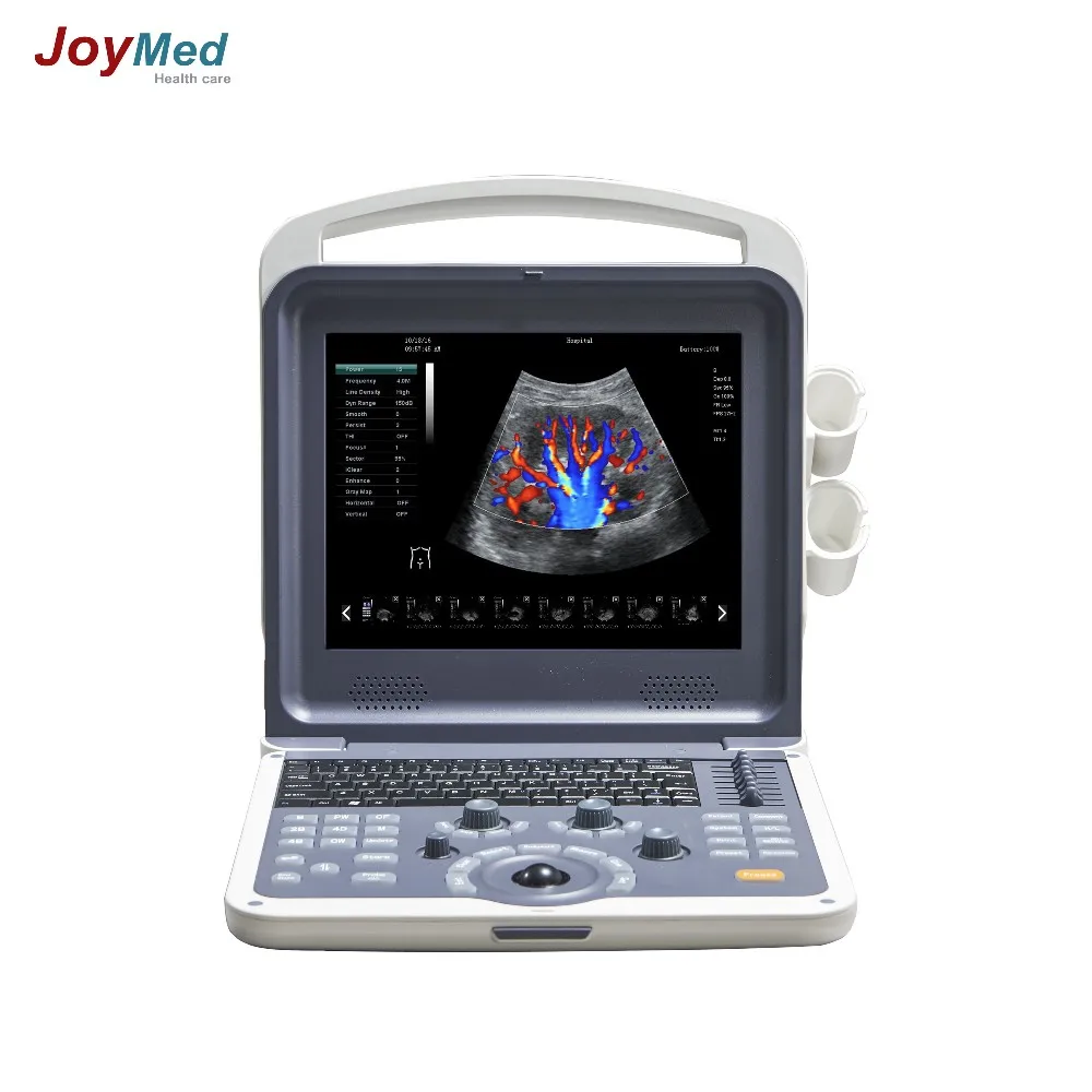 Jm-950c Ob&gyn Portable Ultrasound Machine 4d Color Doppler Ultrasound ...