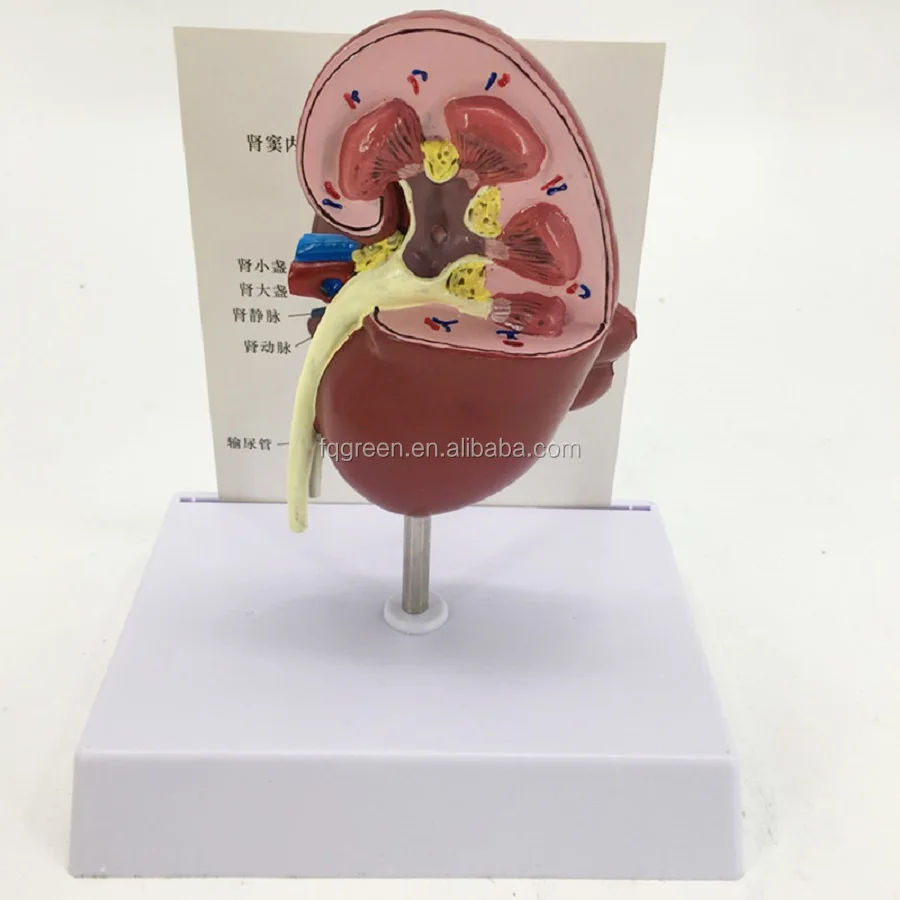 Dissection Model of Kidney and Cyst - Green Medical Training