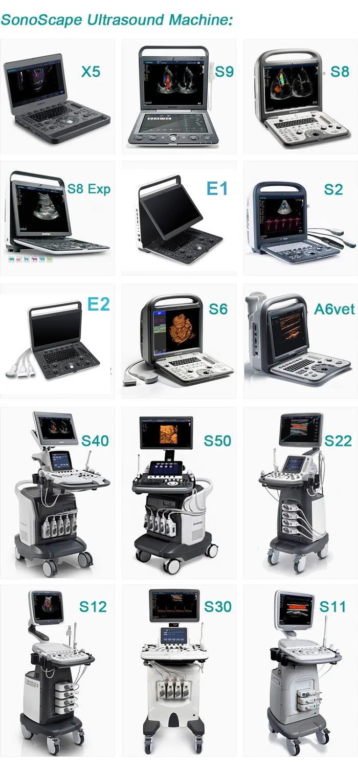 Sonoscape P9 Ultrasound - State-of-the-Art Doppler Trolley