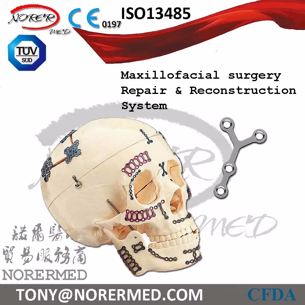 Cmf Titanium Maxillofacial Reconstruction System- Maxillofacial Plate ...