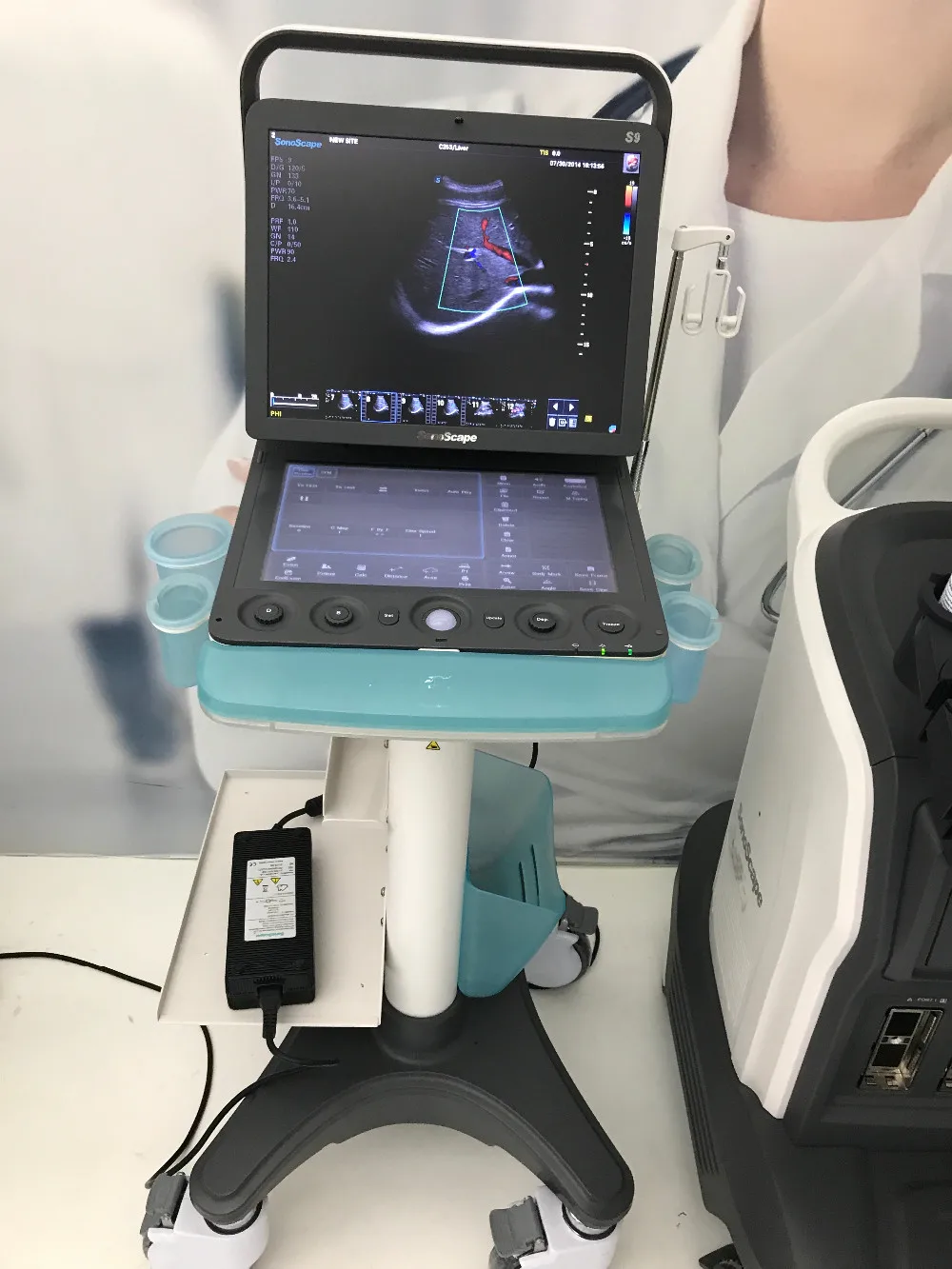 Sonoscape S9 Ultrasound Machine Full Touchscreen Portable Color Doppler ...