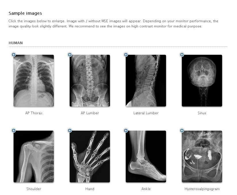Direct Digital Radiography Ccd Imaging Sensor Naomi Ccd Digital Imaging ...