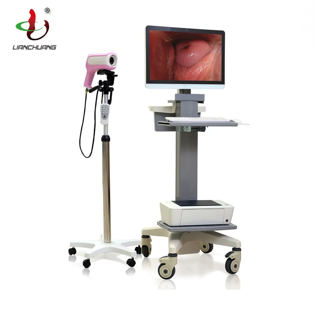 Hot Sale Gynecological Leep Surgery Equipment For Gynecology - Buy Leep ...