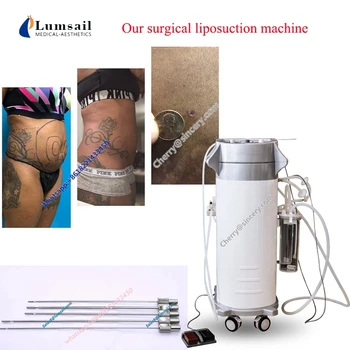 Surgical Power Assisted Liposuction Machine - Buy Reciprocating Cannula ...