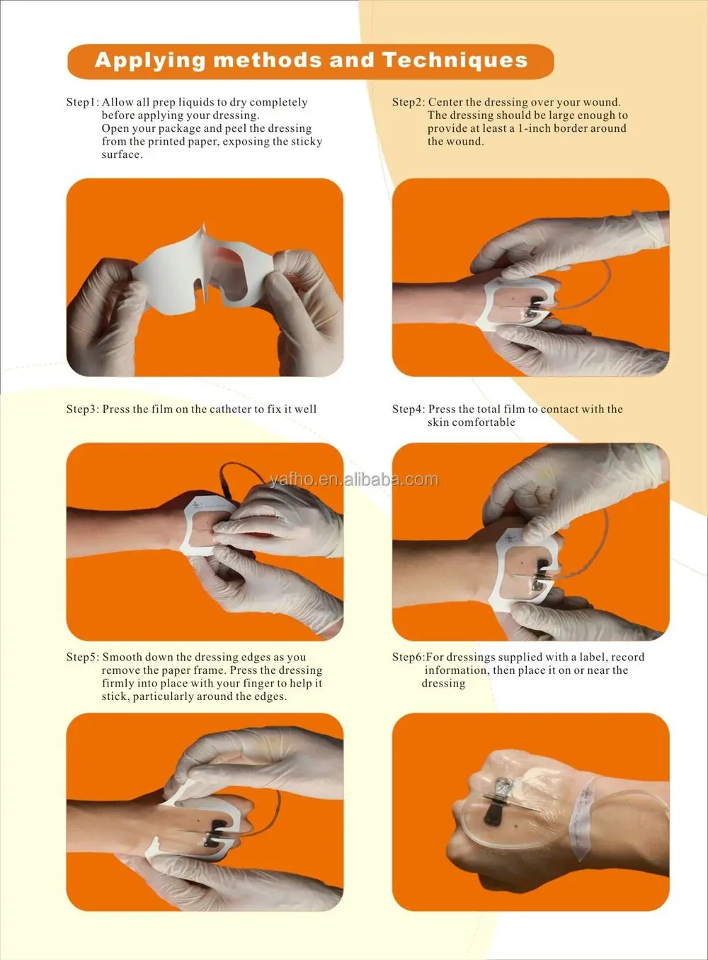 Securefix Pediatric Iv Dressing Transparent Film Dressing - Buy ...