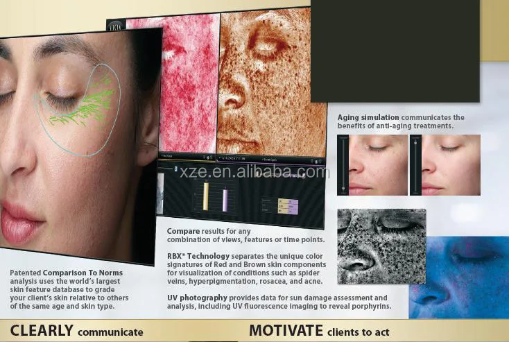 Visia Skin Scanner Analysis Machine Dermatology 3d Skin Analyzer Beauty ...