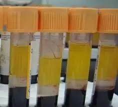 Milky Paste Mixture Blood Separation Addtives For Blood Collection Tube ...