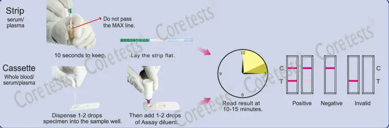 Tb Tuberculosis Rapid Diagnostic Test Device - Buy Tb Rapid Diagnostic ...