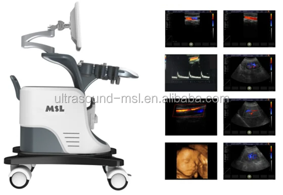 4D Ultrasound Machine - Portable Scanner with CE Certification, 15-Inch ...