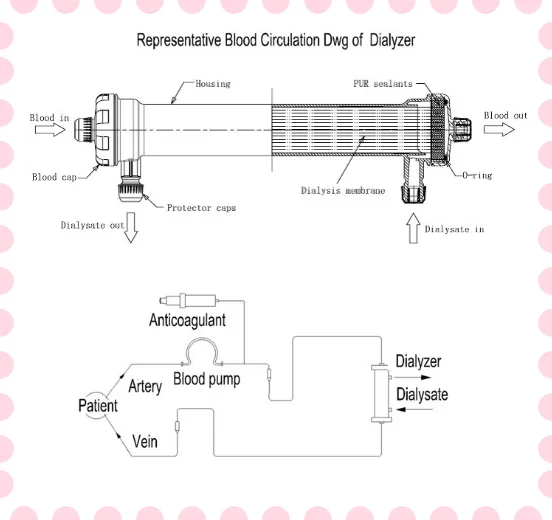 Dialyzer /hemodialyser /blood Purification /high,Low Flux ...