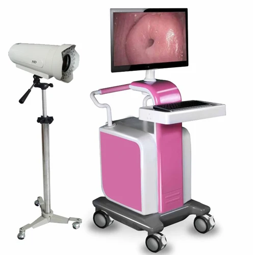 Cervical Abnormal Colposcopy Colposcope Kolposkopie Colorscope Machine ...