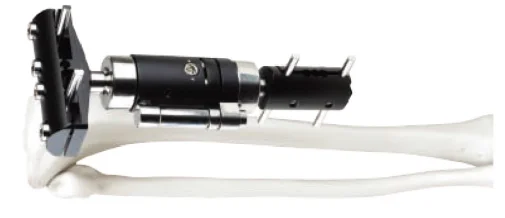 Dynamic Axial External Fixator Orthopedic External Fixation - Buy ...