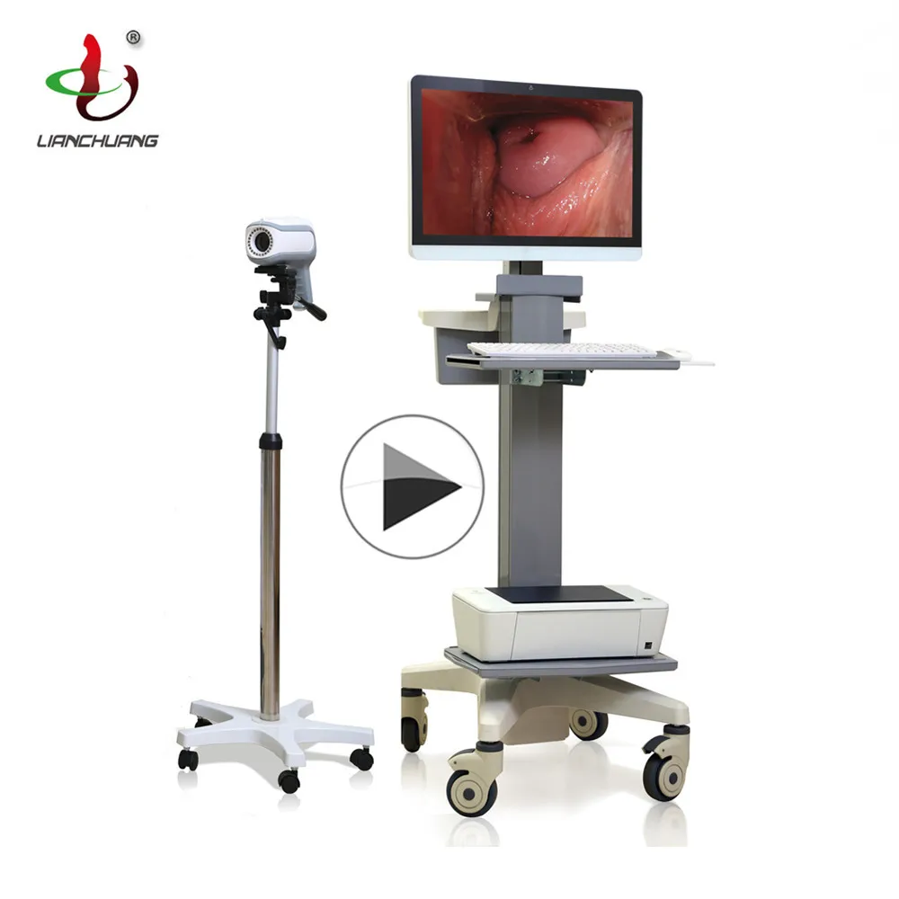 Digital Camera Colposcope Machine/electronic Colposcopy Instrument For ...