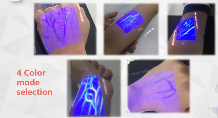 Vein Illumination System Handheld Medical Infrared Vein Finder,Vein ...