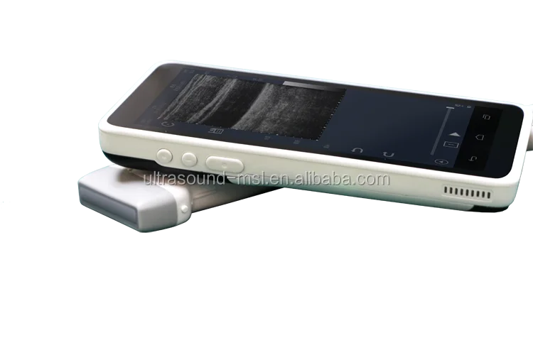 Cheap Price Monitor Integrated Ultrasound Portable Usg With Color ...
