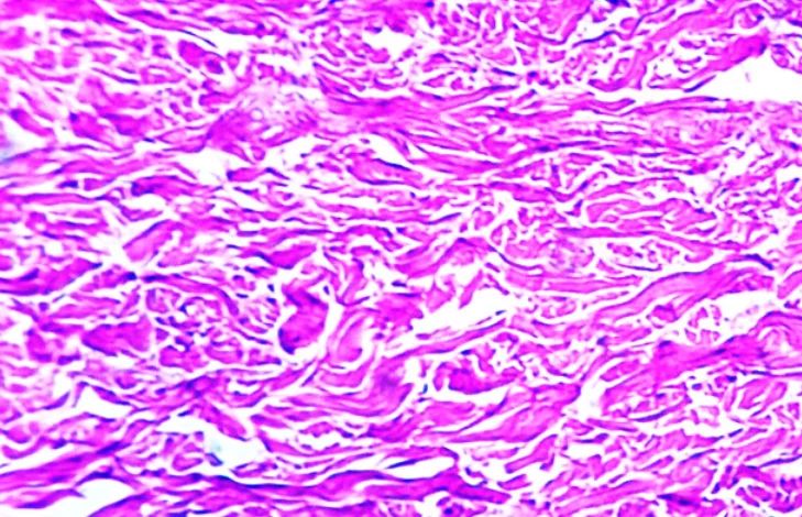 200pcs Human Pathology Slides Set,Pathological Prepared Slides ...