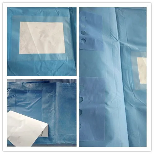 Disposable Sterile Thyroid Drape Pack - Buy Sterile Thyroid Drape Pack,Thyroid Pack,Thyroid ...