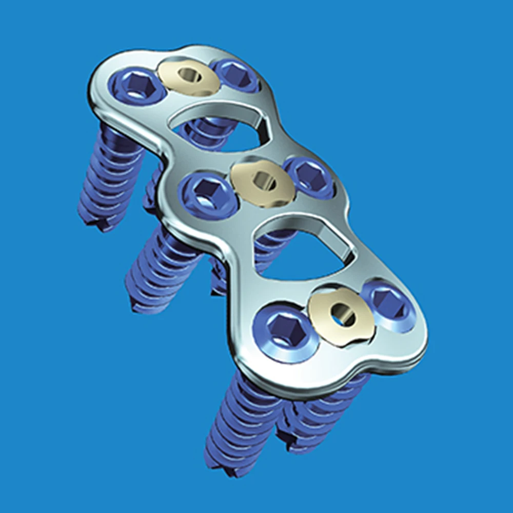 Fda Insured Orthopedic Implants Spine Internal Cage - Buy Fda Insured ...