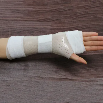 Thermoplastic Fracture Splint Radial Bar Wrist Cock-up Splint For Wrist ...