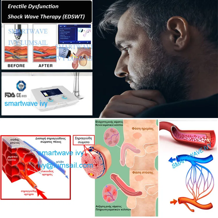 Portable Shock Wave Therapy Machine For Pelvic Chronic Pain Syndrome ...