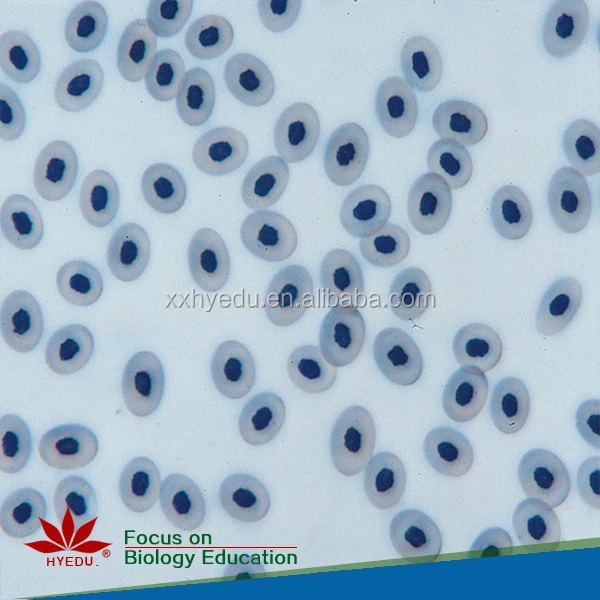 Individual Acute Lymphoblastic Leukemia Smear(l1) Slides