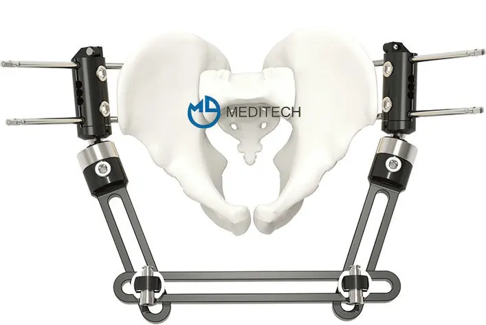 Orthofix Pelvic Fragment External Fixator Type A - Buy External Fixator ...