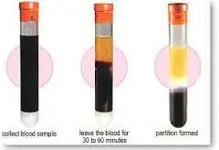 Milky Paste Mixture Blood Separation Addtives For Blood Collection Tube ...