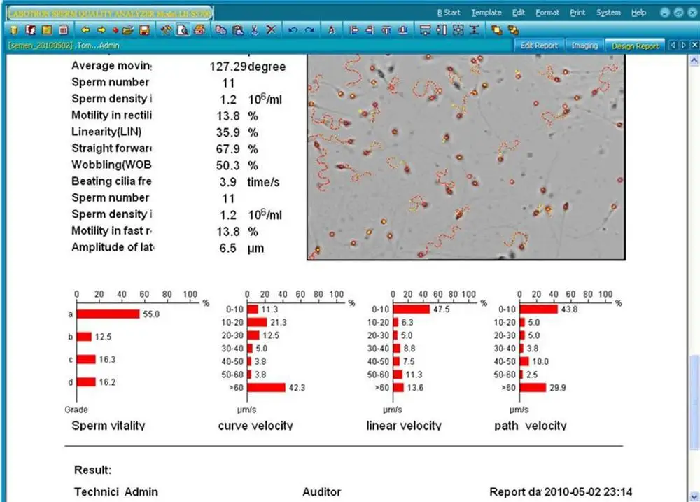 Male Fertility Sperm Analyzer,Automatic Sperm Analyzer Simple Type ...