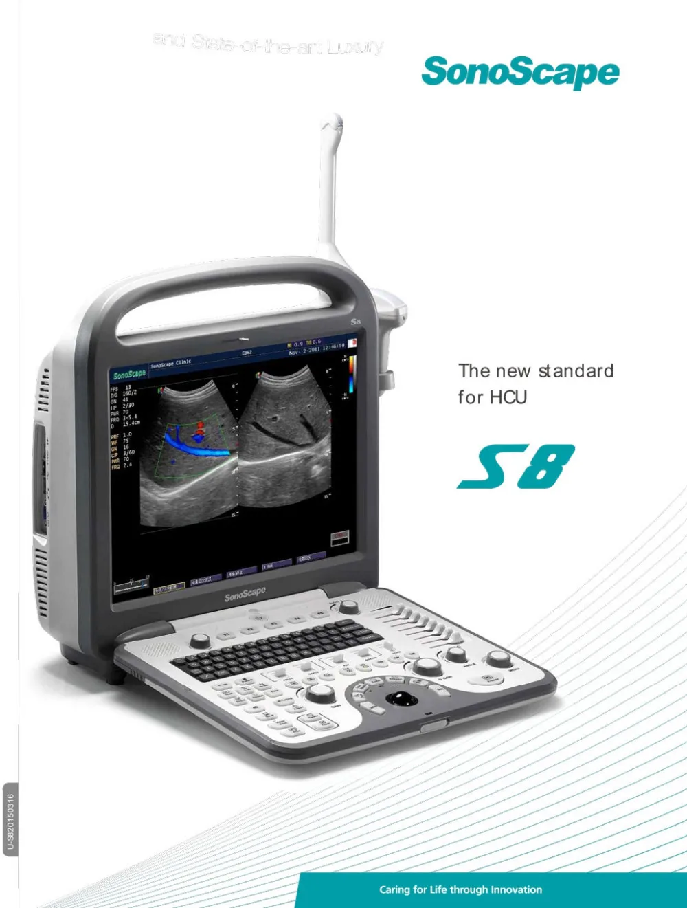 Sonoscape Color Ultrasound Machine/3d 4d Color Doppler Ultrasound ...