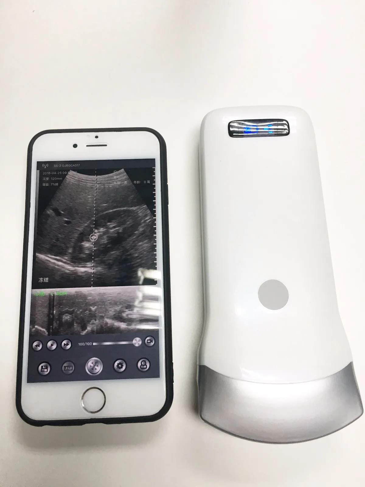 Wireless Usb Ultrasound Probe For Smartphone Wireless Ultrasound Probe ...