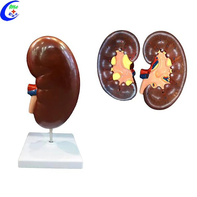 Human Anatomy Kidney Models - Buy Kidney Model,Plastic Kidney Model ...