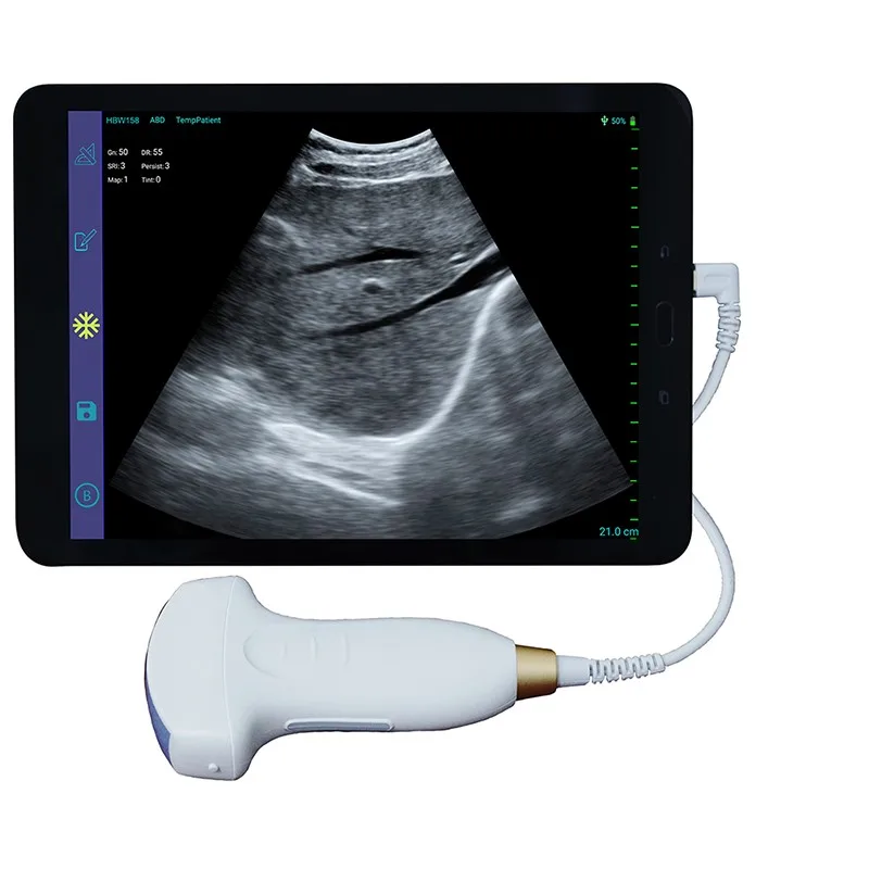 Fda Approved 3.5mhz Usb Convex Ultrasound Probe With High Imaging ...