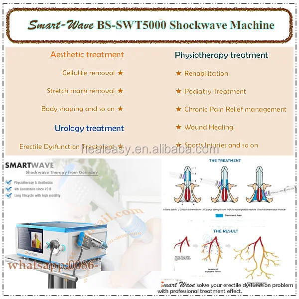 Extracorporeal Shockwave Lithotripsy Eswl Shock Wave Therapy Equipment ...